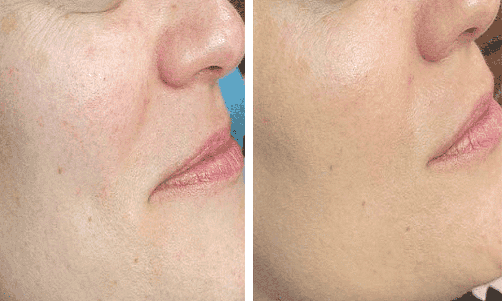 BB Glow - Beauty Aura